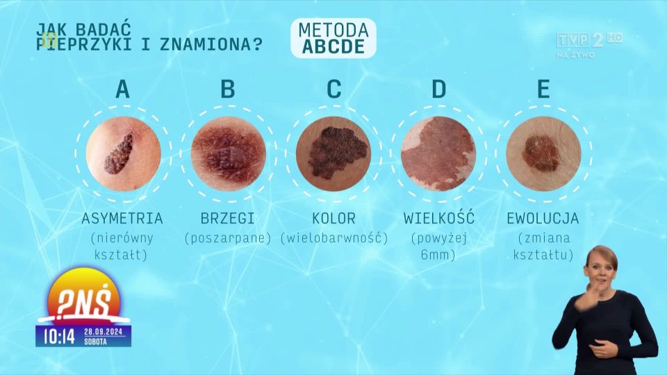 Badanie znamion krok po kroku